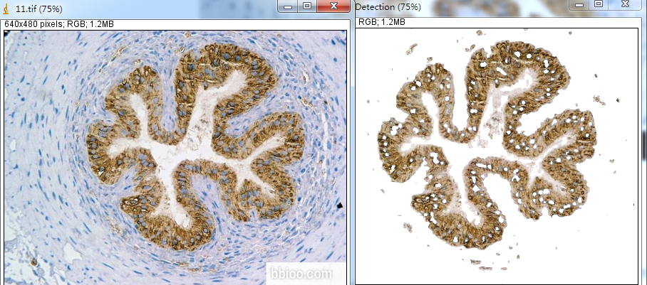 ImageJ的一些基本操作 - 知乎