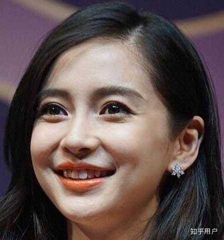 笑肌断层怎样导致的 或者怎样改善？ - 知乎