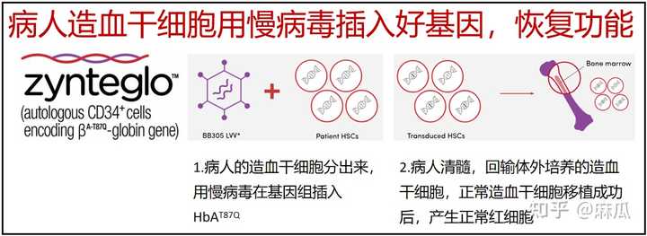 全球首款 CRISPR 基因编辑疗法获批上市，具有怎样的里程碑意义？ - 知乎