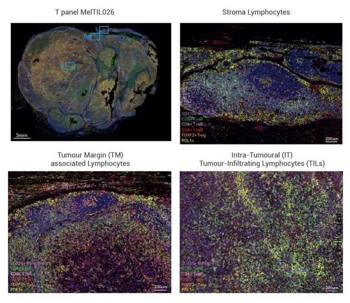 多重荧光免疫组化技术 (mIHC) 的原理什么，与 IHC 和 IF 有何区别？ - 知乎