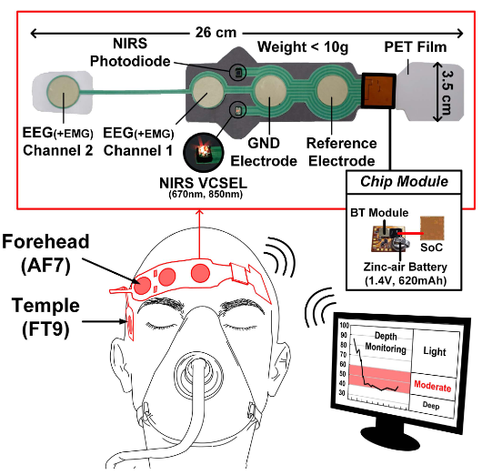 EEG,ERP,MEG,fMRI,DTI,PET,rTMS,NIRS的设备各有什么优缺点呢？ - 知乎