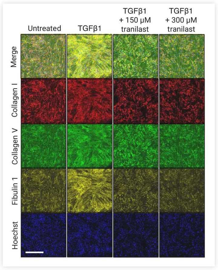 有没有人可以通俗易懂的讲一下什么是高通量筛选？ - 知乎