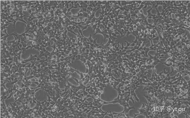 293T细胞总是漂起来，究竟是什么原因呢？ - 知乎