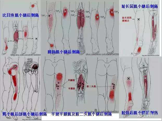 有什么很好的放松小腿肌肉的方法? 知乎