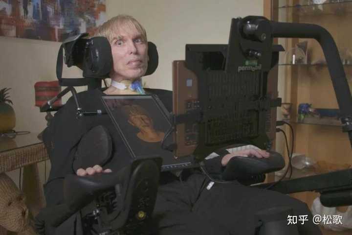 世界第一个生化改造人科学家彼得博士死亡，如何看待此事？赛博格的未来将是怎样？ - 知乎