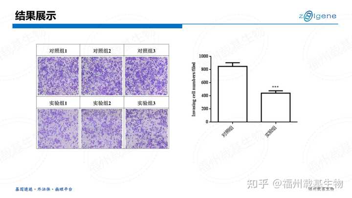 transwell侵袭实验? - 知乎