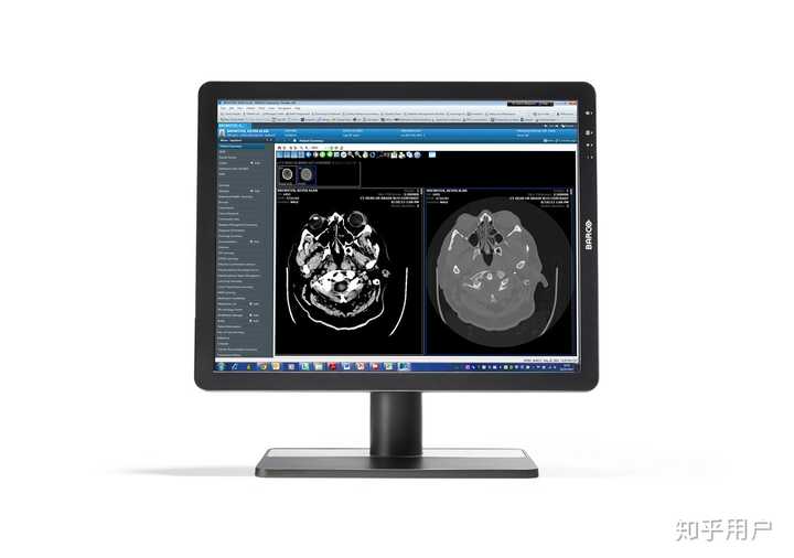 为什么市面上很少见到19寸以上的正屏（方屏）显示器？ - 知乎