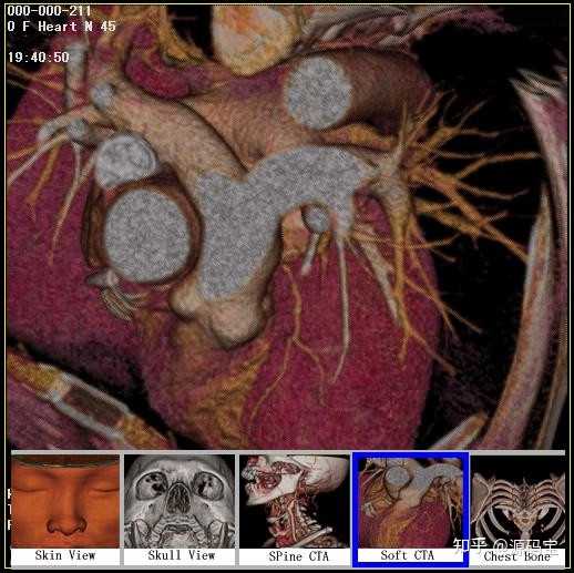 医院的HIS、CIS、LIS、EMR、PACS、RIS、CAD都是指哪些系统，谢谢，请分别回答?? - 知乎