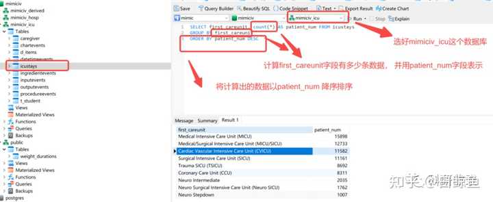 MIMICIV数据库如何提取外科患者信息? - 知乎