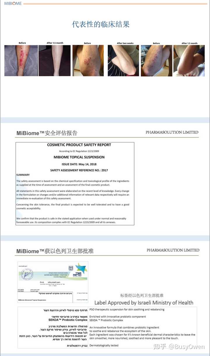 牛皮癣银屑病恢复经验分享? 知乎