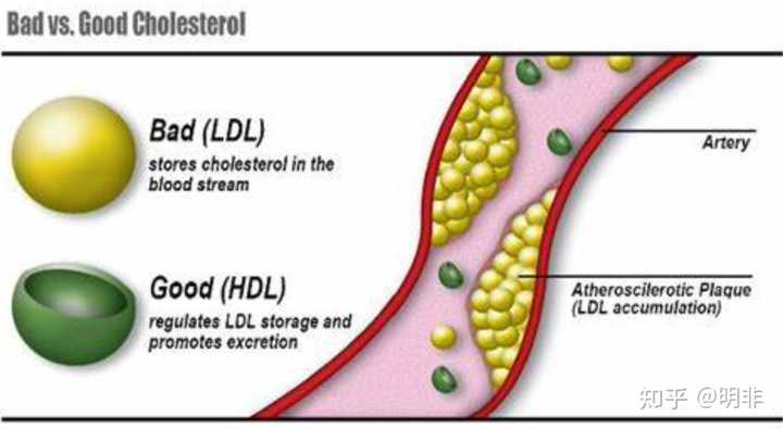首款针对「坏胆固醇」的口服药问世，这对相关疾病患者来说意味着什么？ - 知乎