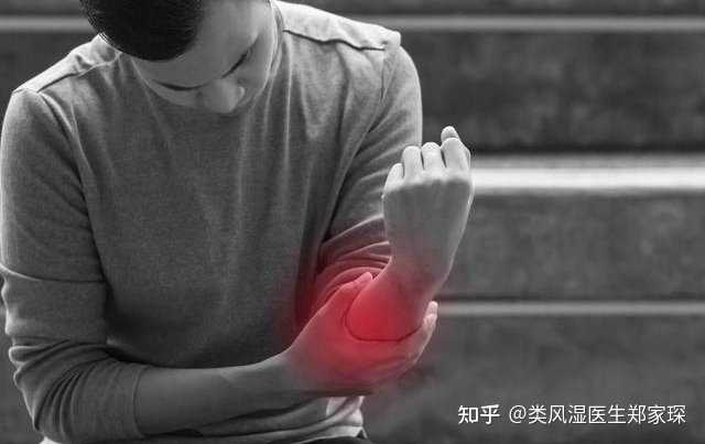 类风湿产生的原因有哪些？ - 知乎