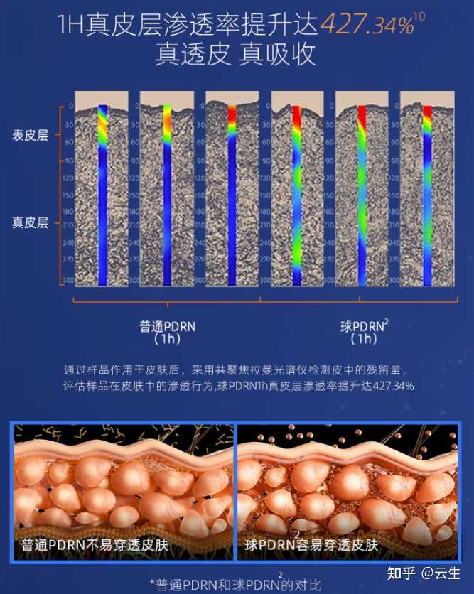 什么是PDRN？ - 知乎