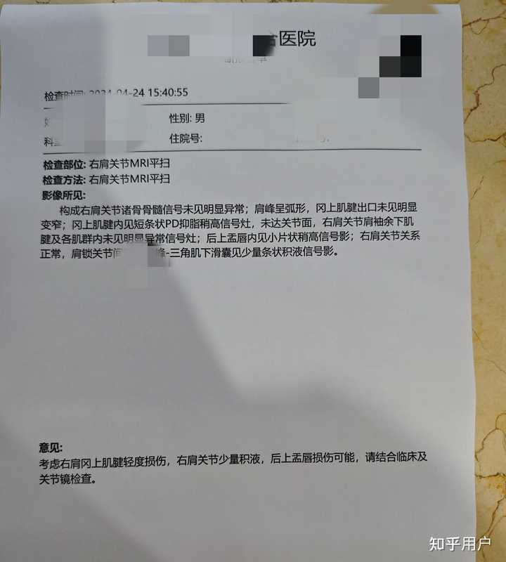 请问卧推100kg的胸肌有多大，可以发你们自己的照片? - 知乎