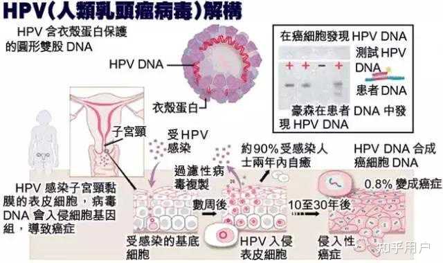 HPV 的致病机制是什么？ - 知乎