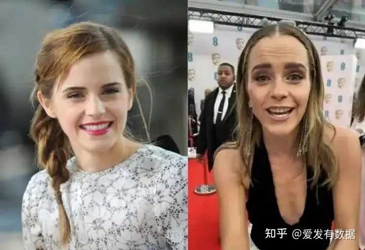 为什么欧美人脱发的比率要其他的国家要高？ - 知乎