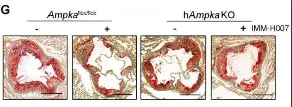 AAV PCSK9用于动脉粥样硬化疾病造模效果如何？ - 知乎