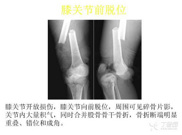解剖学-关节总论 - 知乎