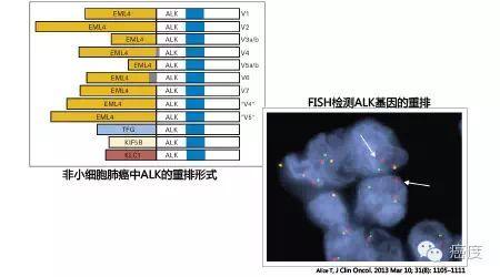 非小细胞肺癌EML4-ALK靶向药物机制及逆转耐药 - 知乎