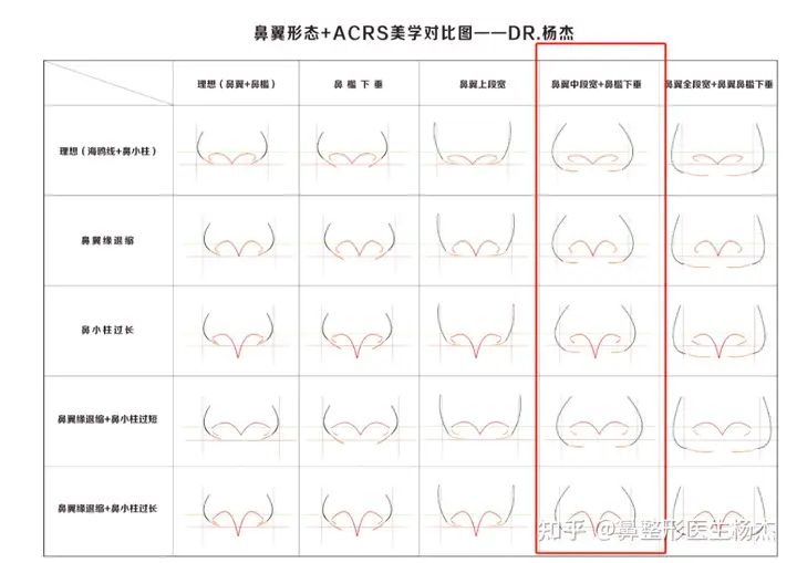 奥运观后感——鼻翼形态及ACRS美学元素变化图_杨杰_主治医师_爱问健康