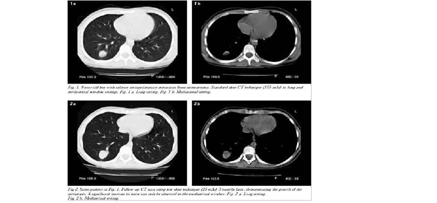 CT的成像原理是什么？ - 知乎