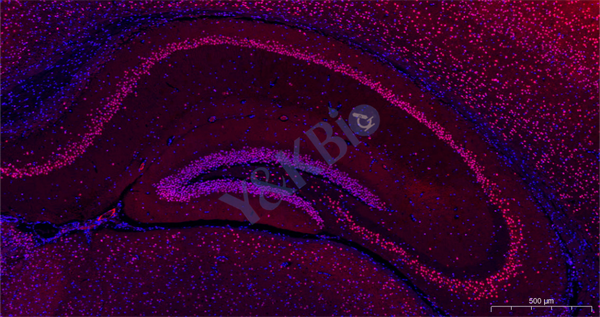 脑组织实验前处理方法及常做的染色 - 知乎