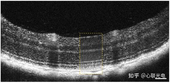 J BIOMED OPT：用于小鼠视网膜体内成像的自适应光学OCT - 知乎