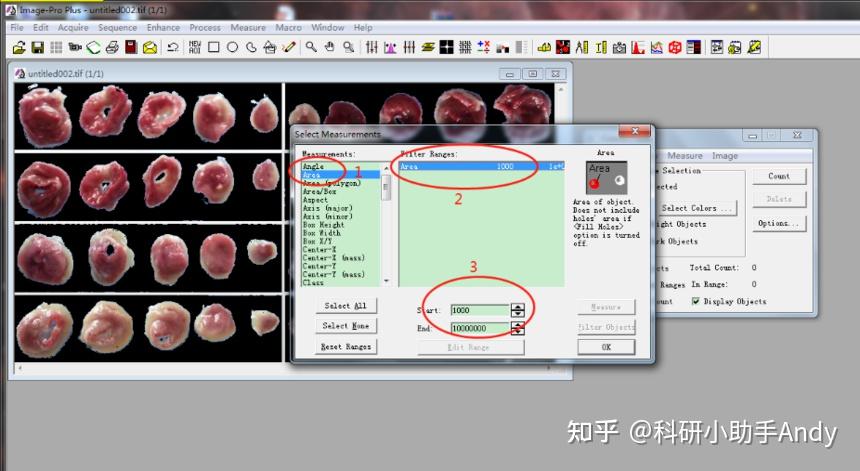 TTC染色详细计算分析过程，步骤详解（组图） - 知乎