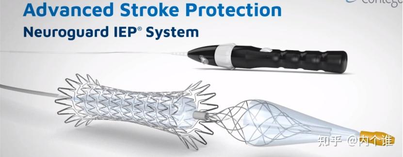 【行业资讯】带有抗血栓保护装置的颈动脉支架 - 知乎