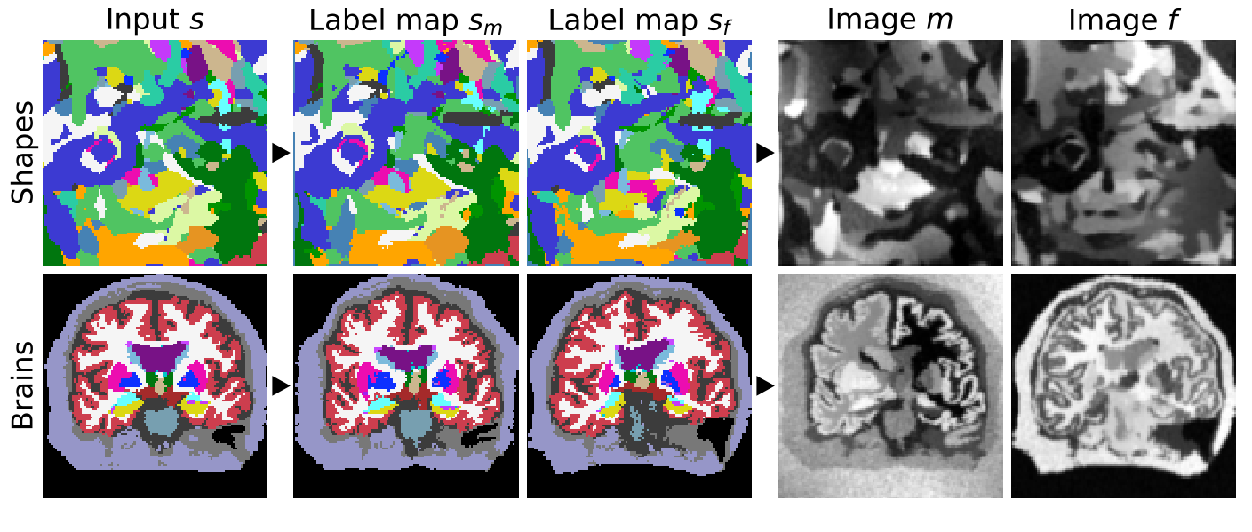 分割图——SynthMorph，零样本学习完成跨模态配准任务 - 知乎