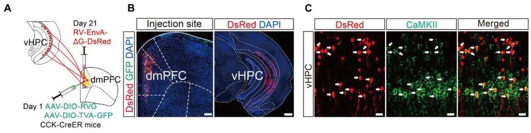 【知识窗】RV逆行跨一级示踪技术详解 - 知乎