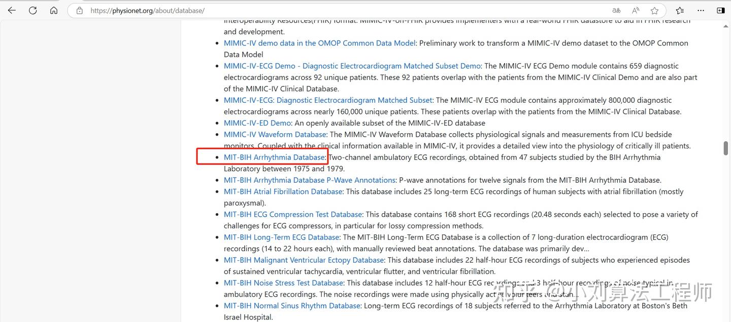 「ECG信号处理-第一课——认识MIT-BIH数据库」2024年10月25日 - 知乎