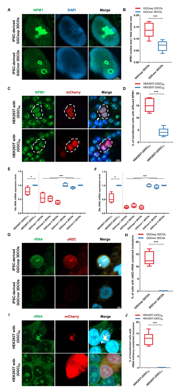 项目文章 | 单细胞测序揭示NOTCH2NLC基因GGC重复扩增导致核糖体生物生成及翻译障碍 - 知乎