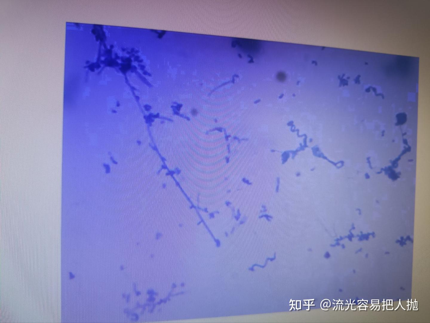 微生物实验之酵母菌、放线菌与霉菌的观察以及显微直接计数法后日谈 - 知乎
