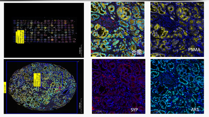 mIHC多重荧光免疫组化TSA - 知乎