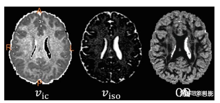 思影科技弥散加权成像（DWI/dMRI）数据处理 - 知乎