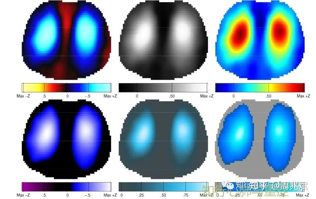 第139期胸部电阻抗断层成像（EIT）的原理、图像分析及临床应用 - 知乎