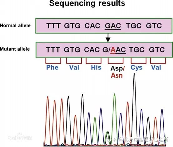 【案例分享】钙通道疾病--CACNA1A基因 - 知乎