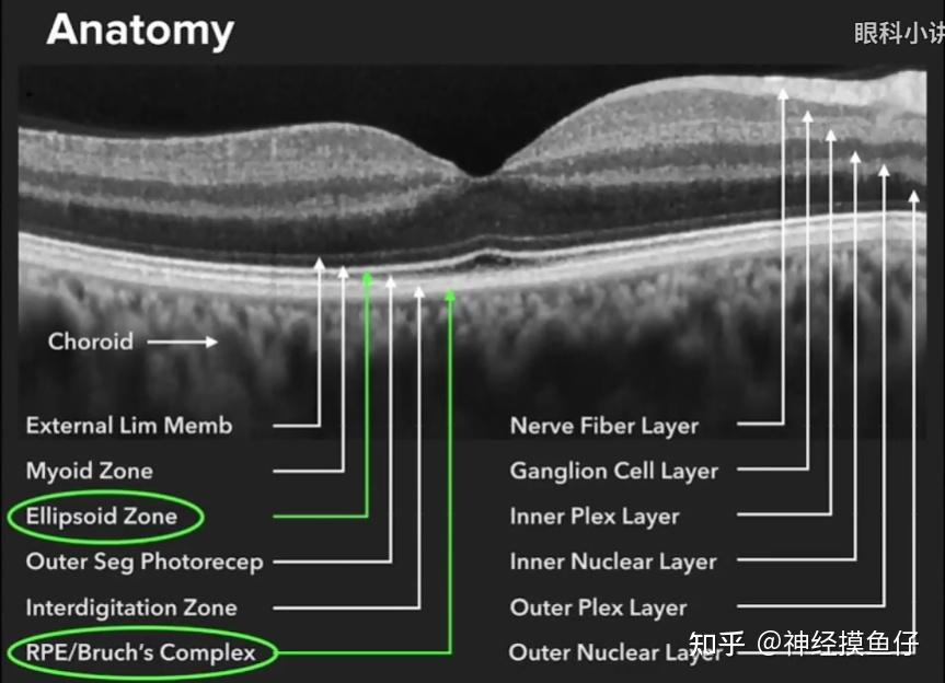OCT阅片（持续更新 - 知乎