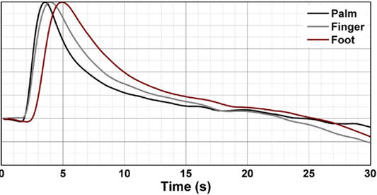 干货｜MATLAB工具箱之使用PsPM处理皮肤电数据 - 知乎