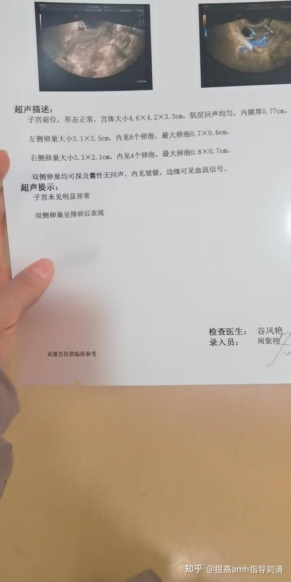 卵泡发育不好,卵泡小,调理两个月反馈监测到2个成熟卵泡! 知乎