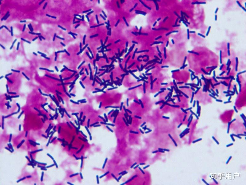 想问这是什么菌的显微镜图片? - 知乎