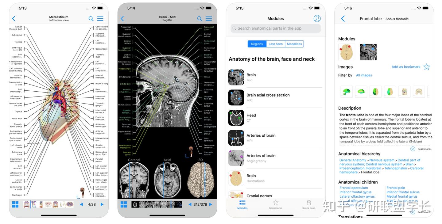 e-anatomy 一款爱不释手的影像软件 - 知乎
