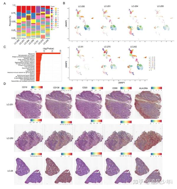 10X单细胞空间联合分析人类小细胞肺癌肿瘤生态系统和空间结构 - 知乎