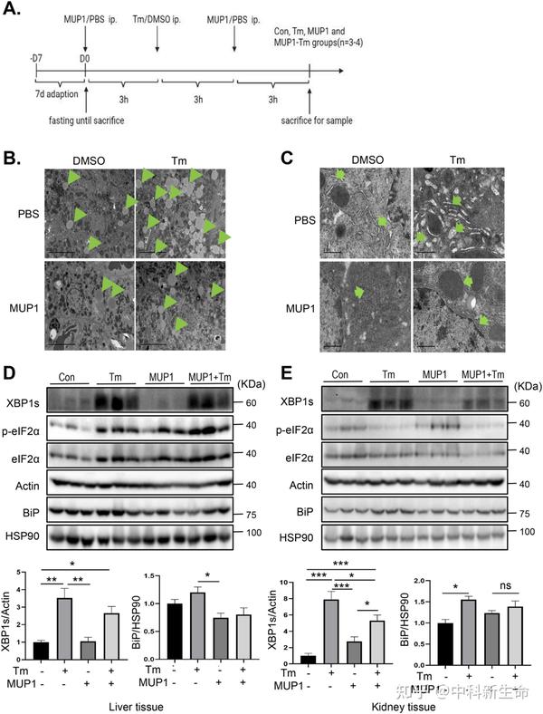 项目文章Pharmacol Res（IF 10）|中山大学附属第三医院利用转录组和蛋白组分析揭示MUP1减轻内质网应激的关键作用 - 知乎