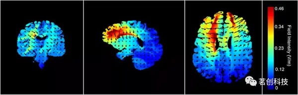 文献速递第3期：tDCS的近期研究 - 知乎