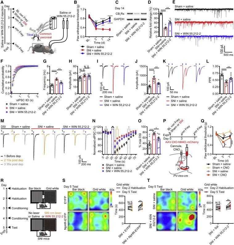 疼痛调节的Po-ZI通路 - 知乎
