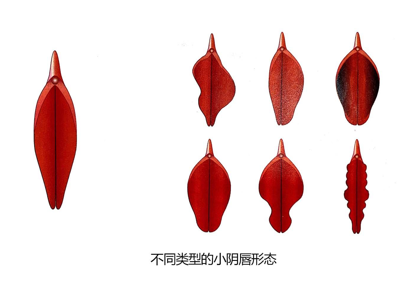 【小阴唇全解】(二)什么样的小阴唇形态是不美观的? 知乎