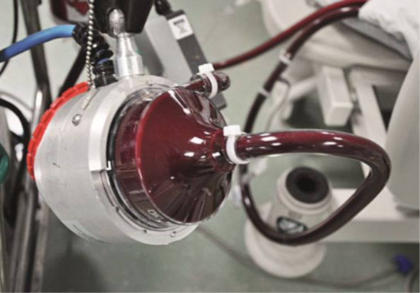 icu多少钱一天？ - 知乎