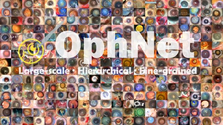 OphNet 眼科手术视频分析数据集 - 知乎